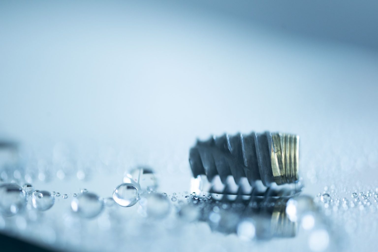 Što je sve uključeno u cijenu implantata? - Orto Nova